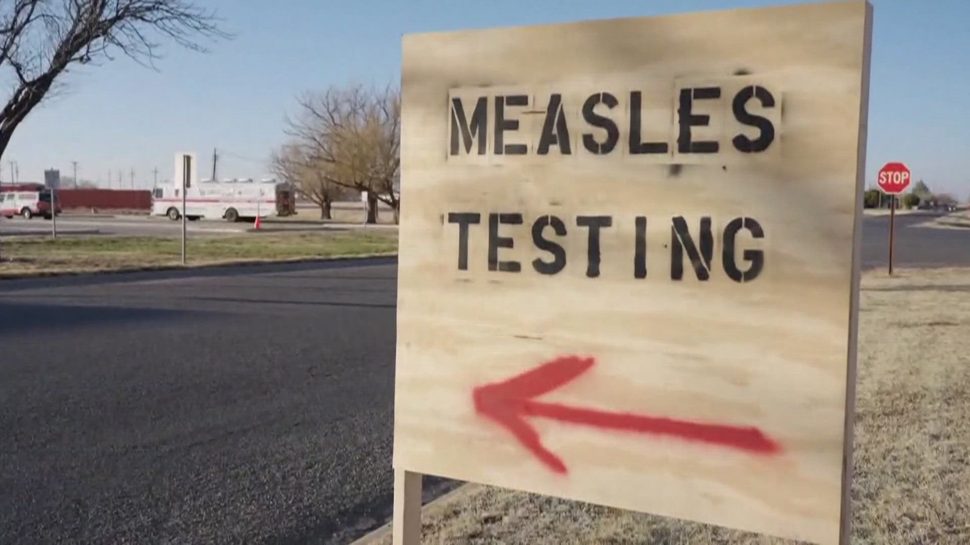 Measles case in San Antonio area: 1 case confirmed by health officials ...