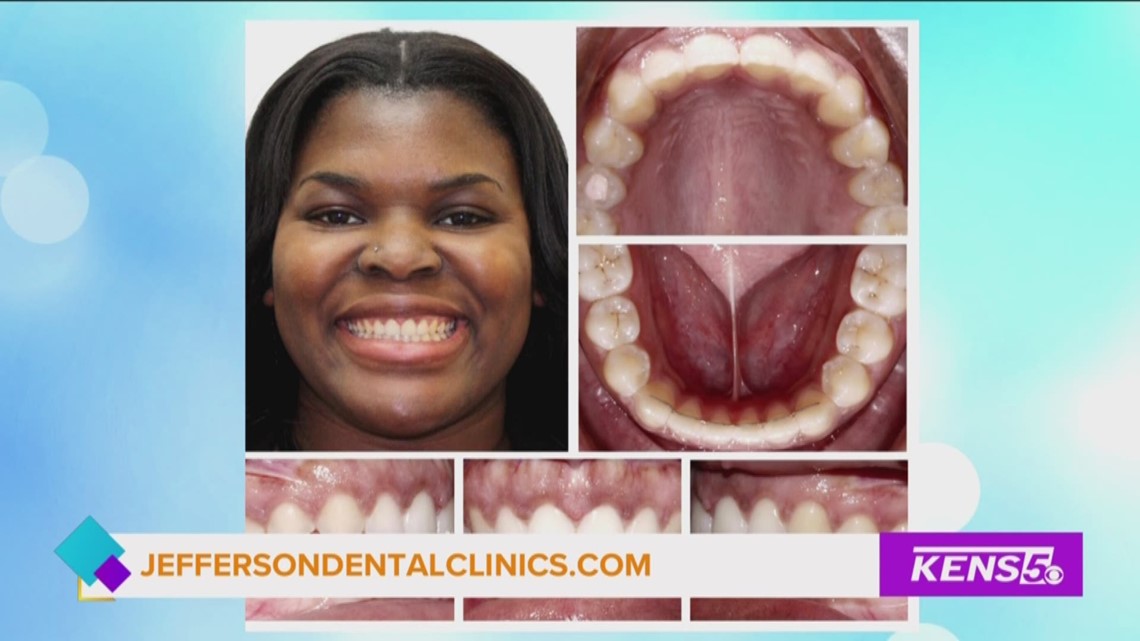 Jefferson Dental | kens5.com