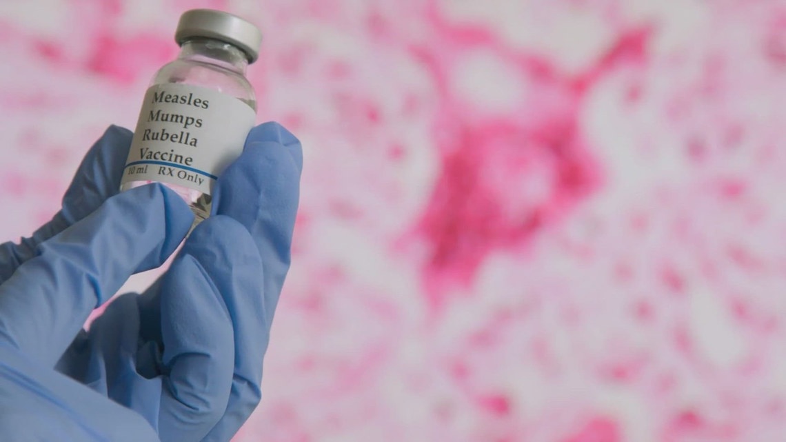 West Texas measles death and outbreak sparking desires for measles ...