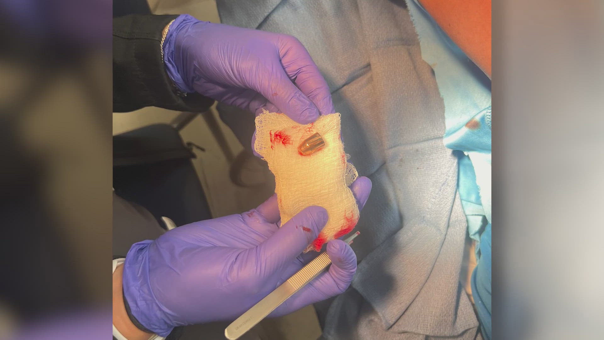 SAPD: Man wounded by stray bullet during New Year celebrations on west ...