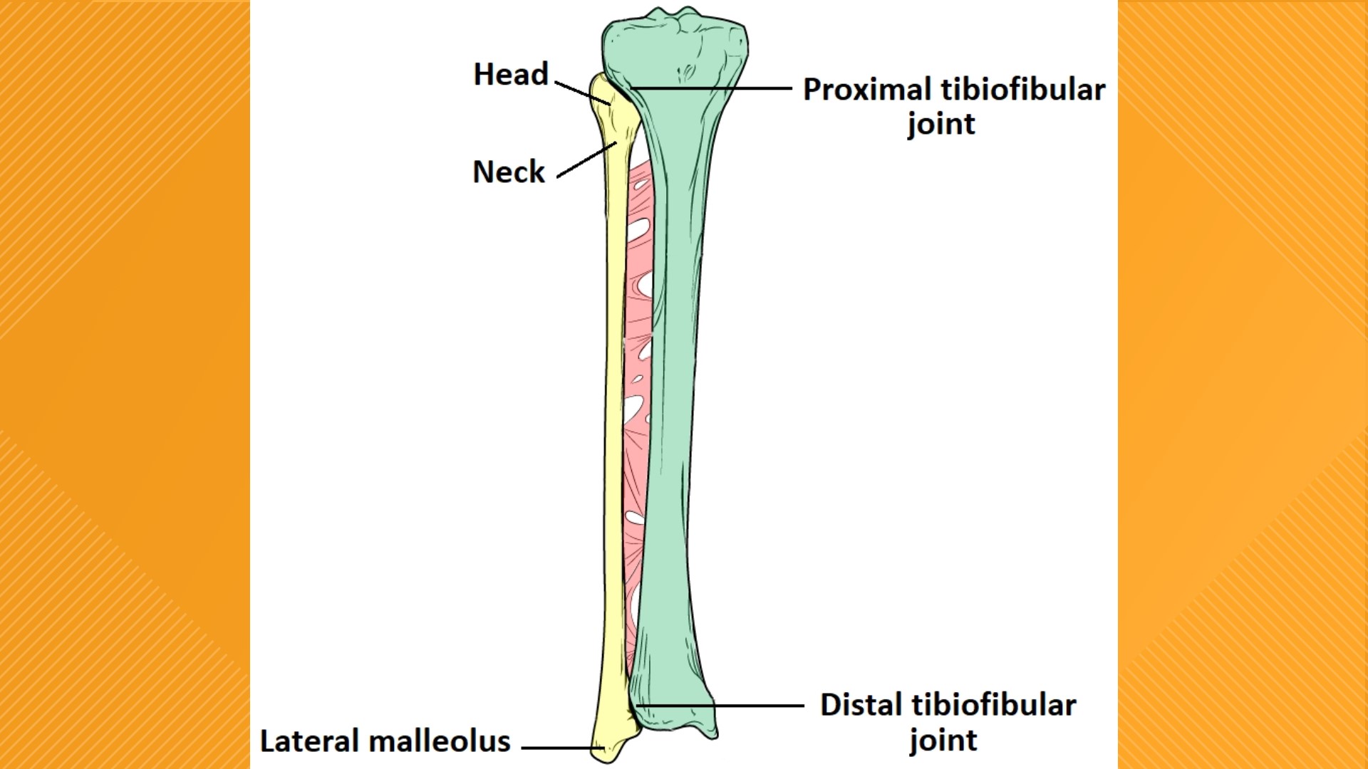 MRI reveals Spurs' Collins fibula fracture | kens5.com