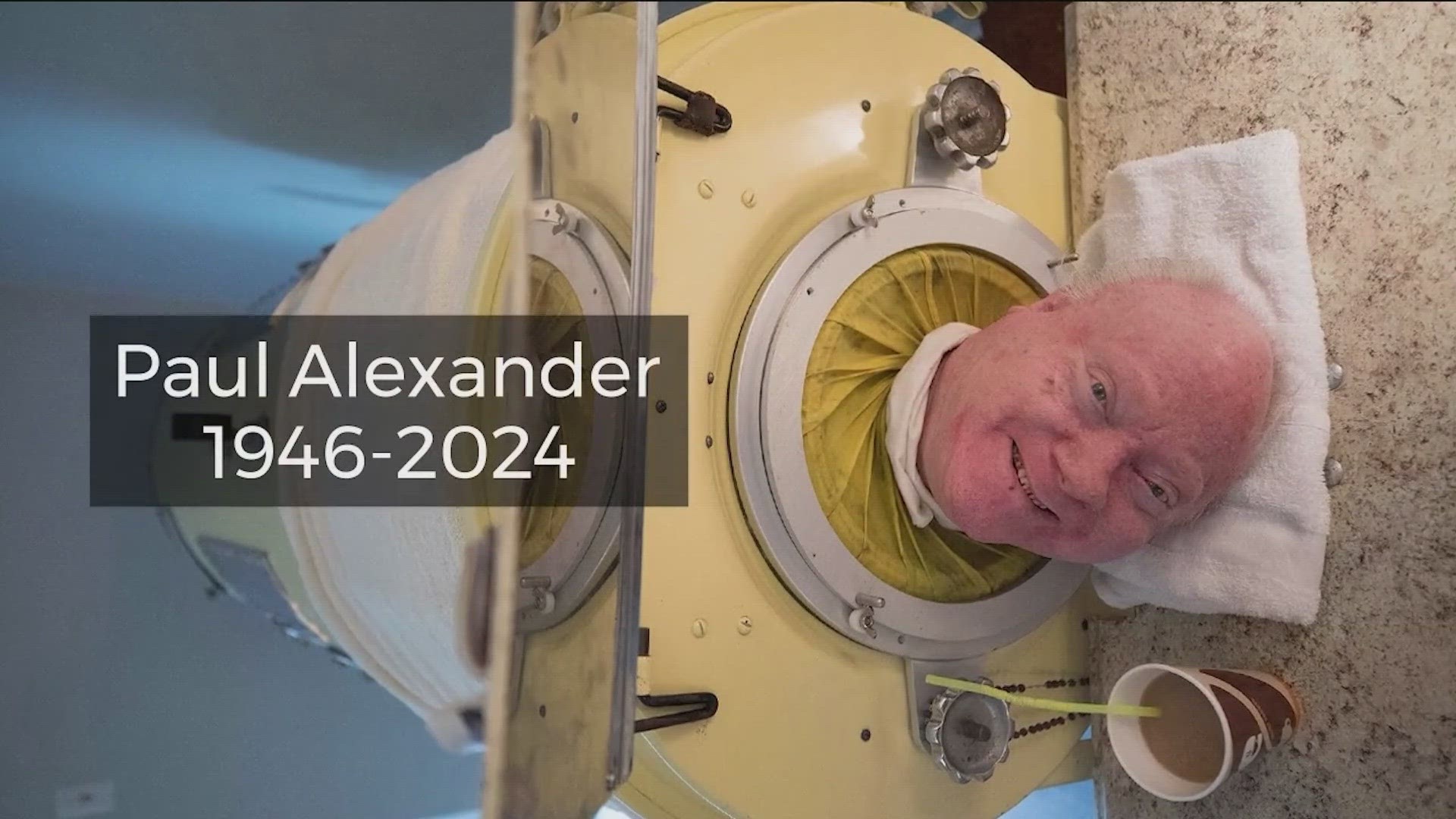 Texas man who lived in an iron lung for 72 years dies | kens5.com