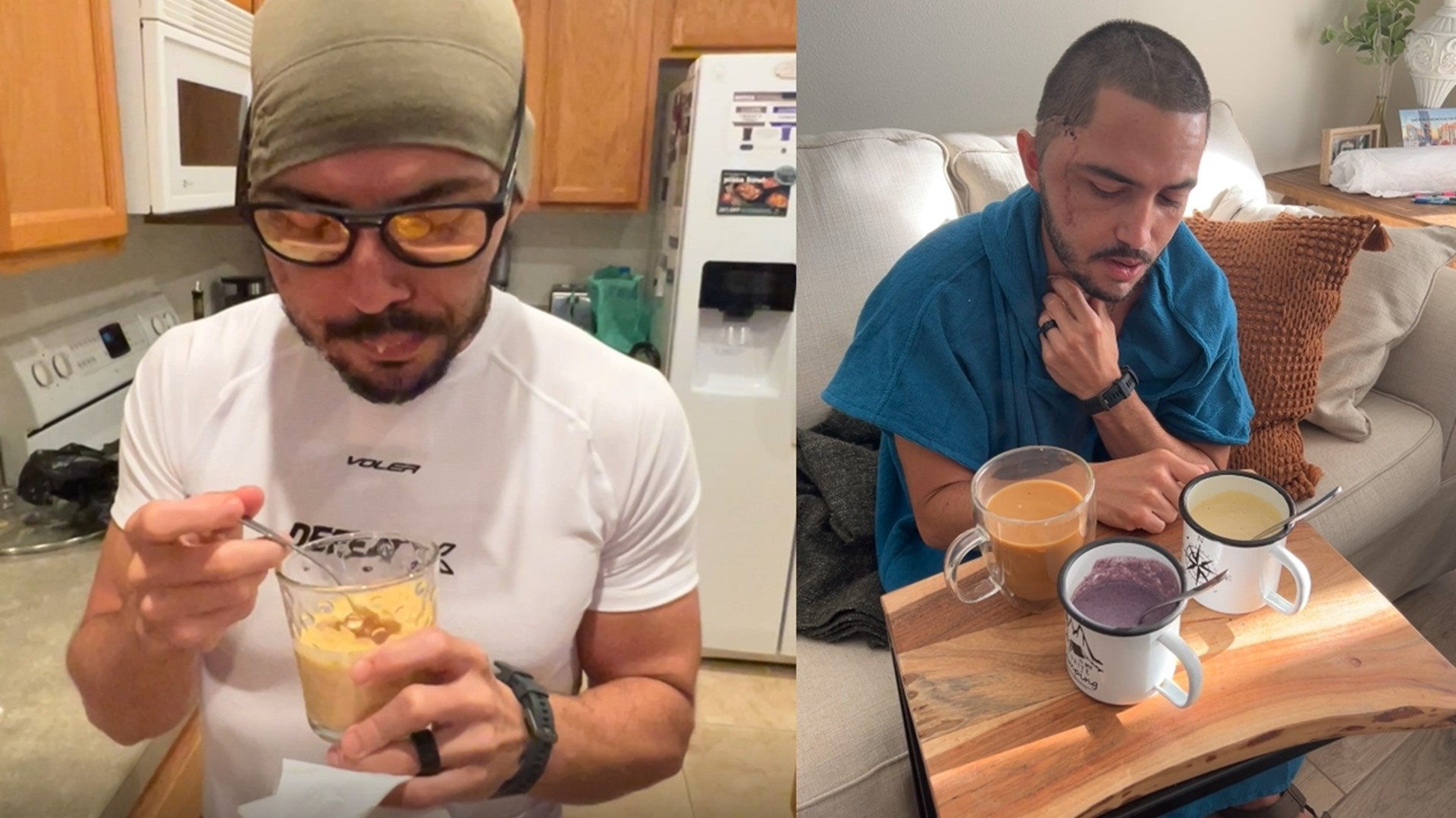 Florida man recounts alligator attack and his recovery journey | kens5.com